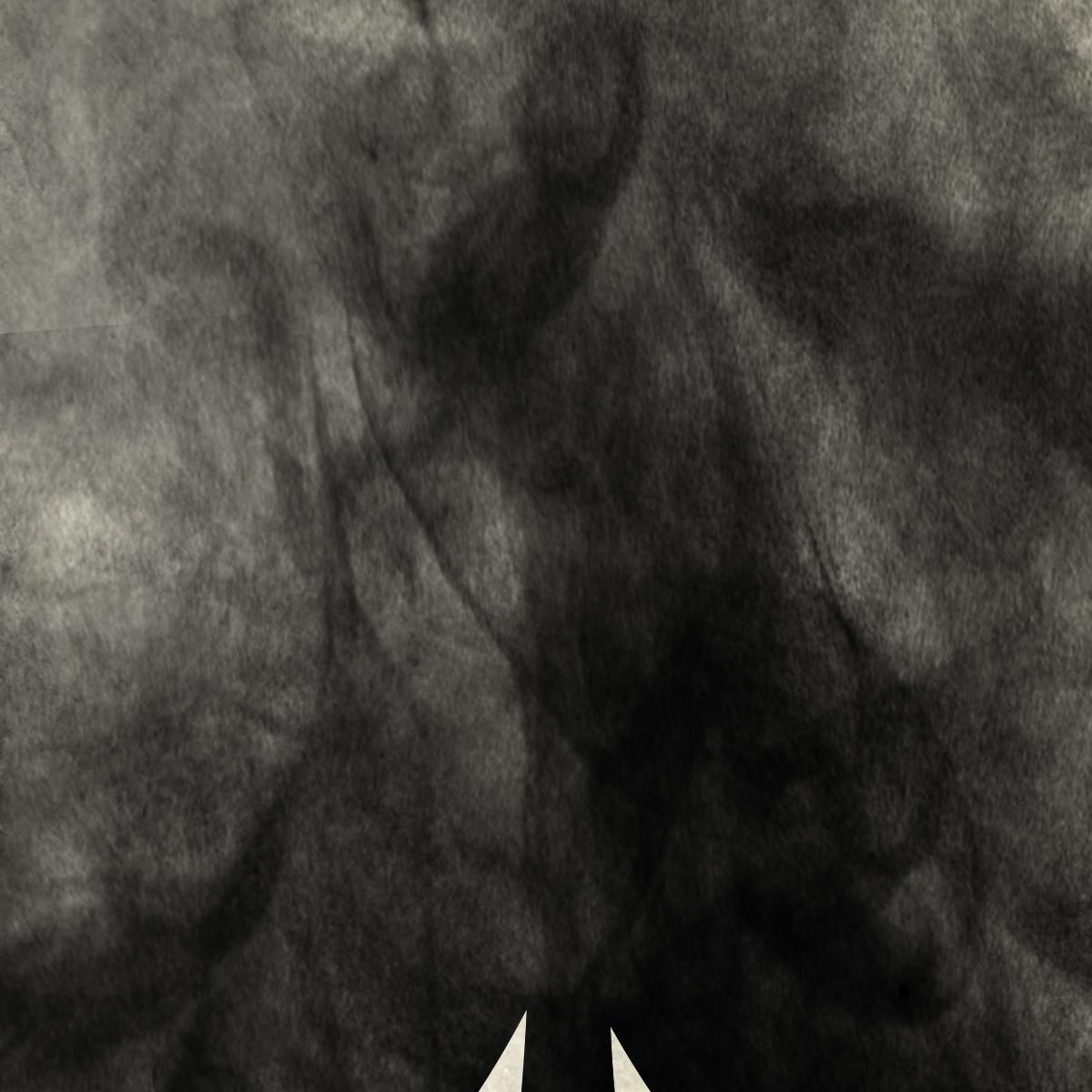 Ace Of Spades Playing Cards Frame canvas print